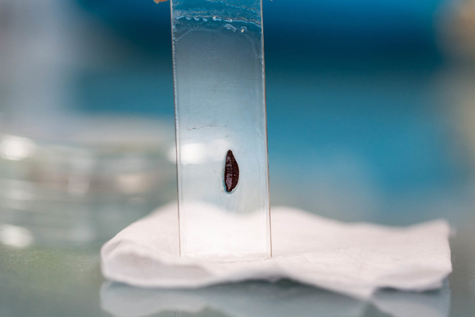 Where to buy leeches and how to proceed after the purchase? - Euro-BION